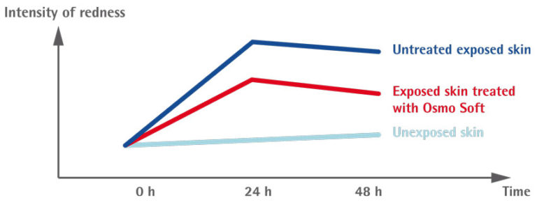 Osmo Soft : 4 in 1 treatment for burns & sunburns