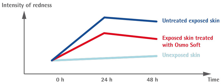 Osmo Soft : 4 in 1 treatment for burns & sunburns